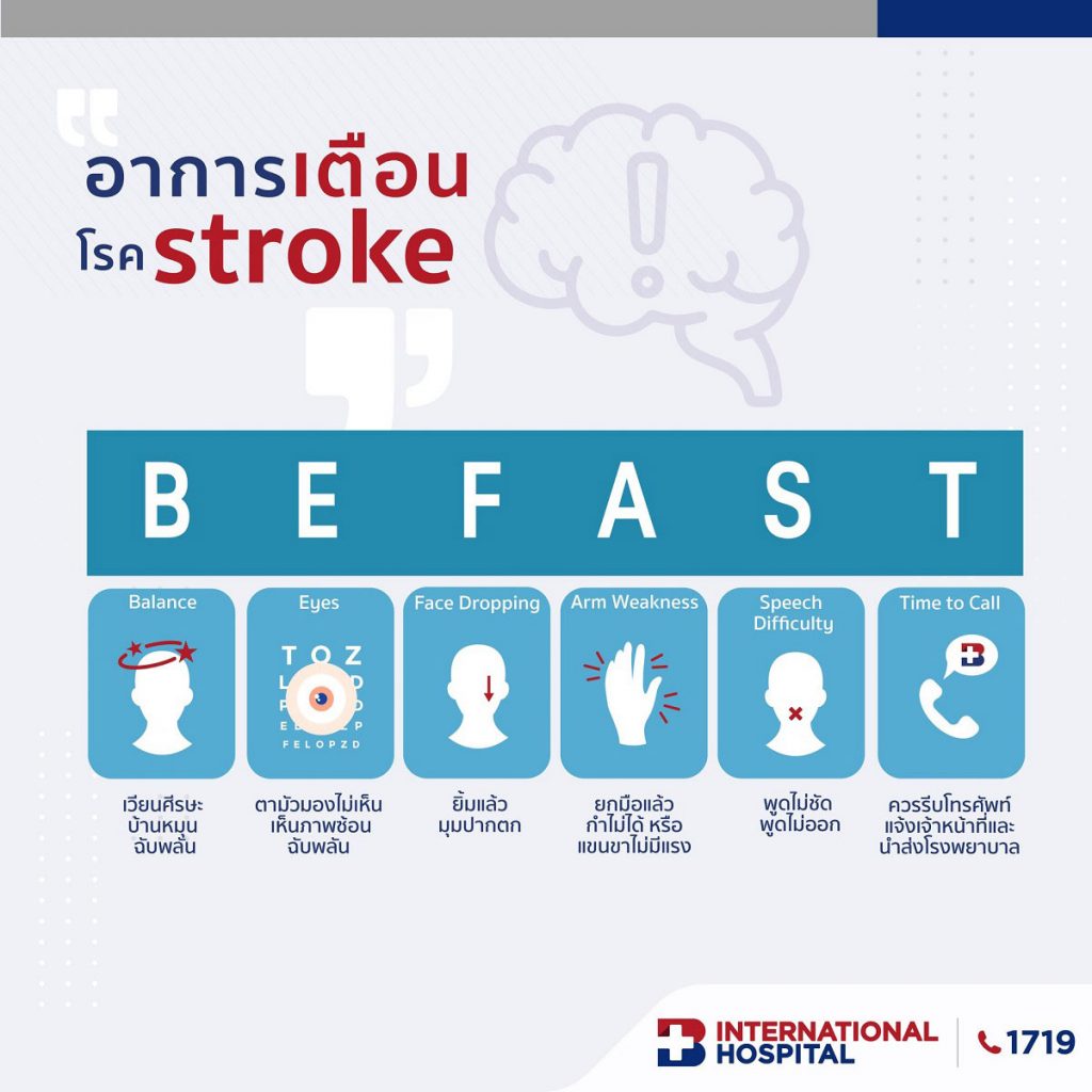 สังเกตอาการเตือน โรคหลอดเลือดสมอง ตามหลักการ BEFAST